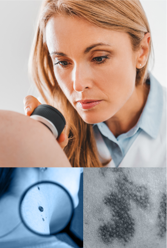 Skin Cancer - Palm Beach Dermatology Group