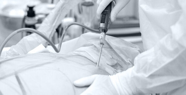 Breast Reduction Surgery - Palm Beach Dermatology Group