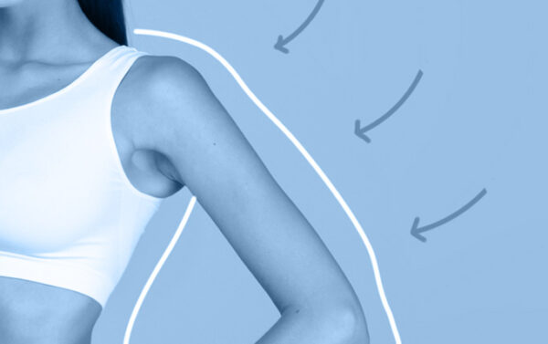 Upper Inner Arm Lift - Palm Beach Dermatology Group