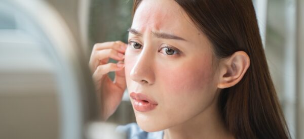 Why Is My Face Always Red? 7 Common Causes and Solutions